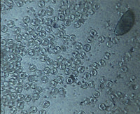 Do it Yourself Fecal Float Test Tutorial – BeardedDragon.co